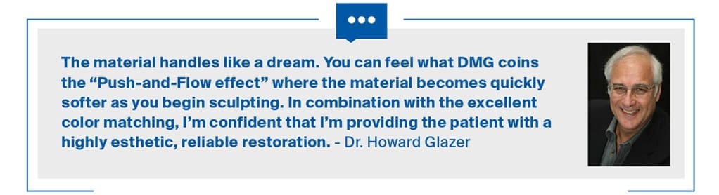 Choosing the Right Composite for Any Situation Just Got Easier - Group ...